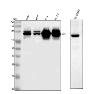 SSH3 Antibody | Slingshot homolog 3 | FY13079