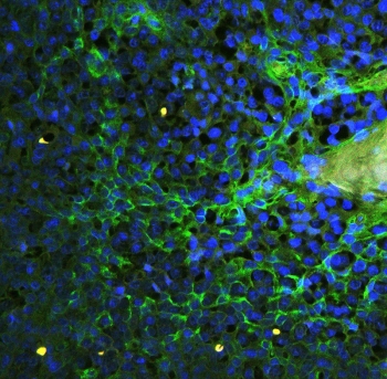 ICAM-1 Antibody | R31450 NSJ Bioreagents