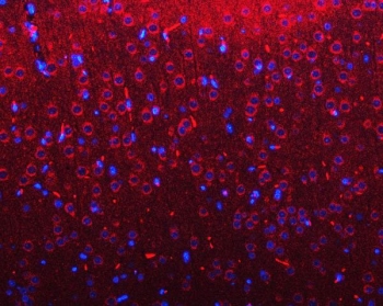 RIMS-binding protein 2 Antibody | RIMBP2 | RQ7851 NSJ Bioreagents